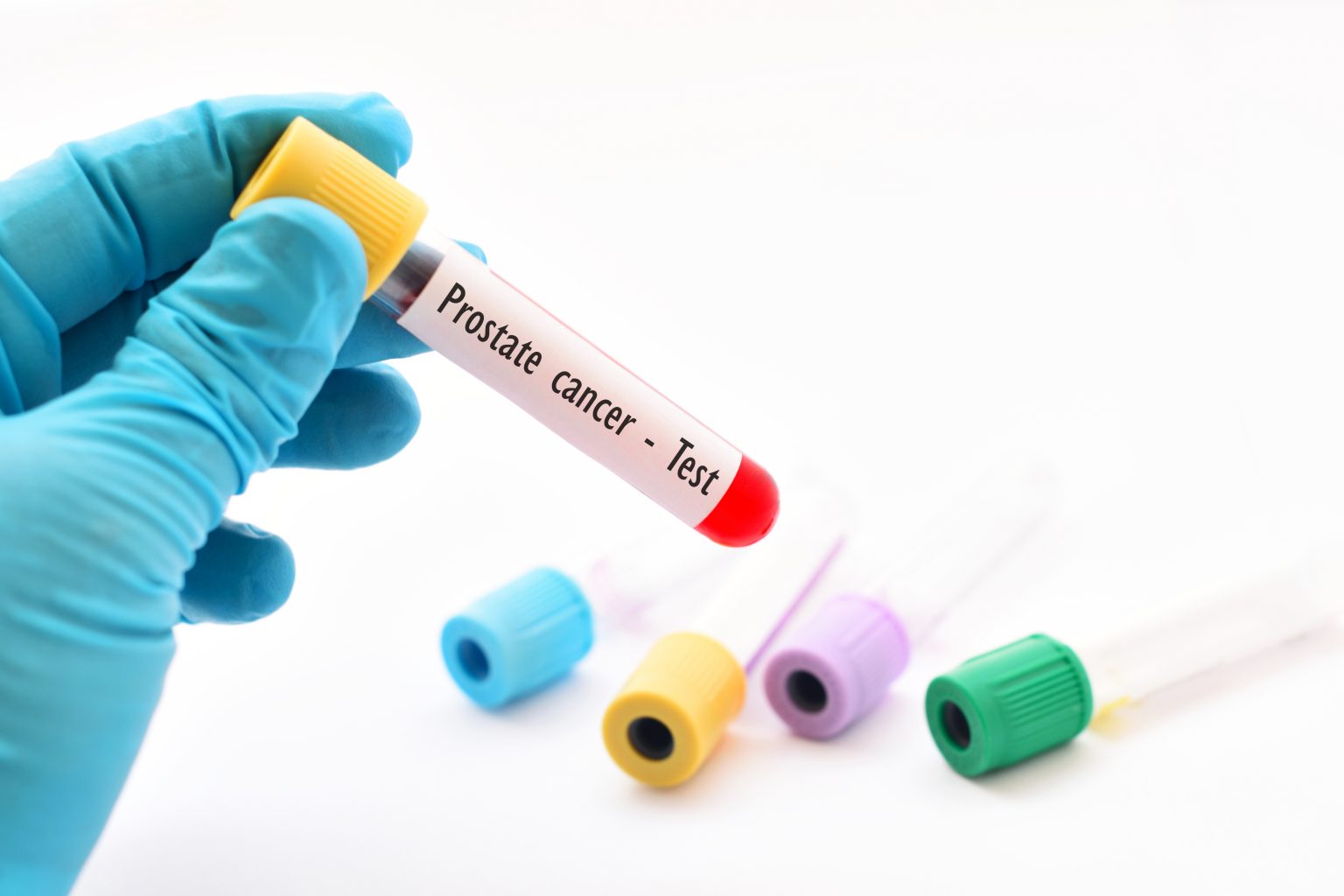 How is prostate cancer tested? Know these diagnostic tests